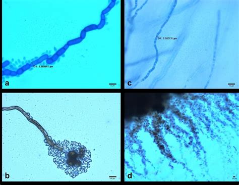 Figure 1 From Electrospinning Nanofibres Of Pullulan Extracted From Phylloplane Fungus