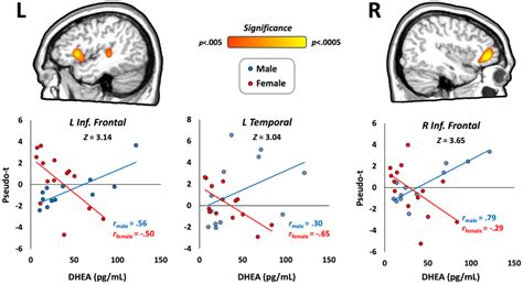 Dhea‐by‐sex Interactions In The Gamma Band Fishers R To Z Maps Showed