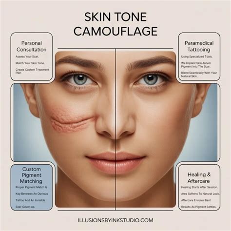 Facelift Necrosis Scar Camouflage Skin Tone Tattoo Solution Illusions
