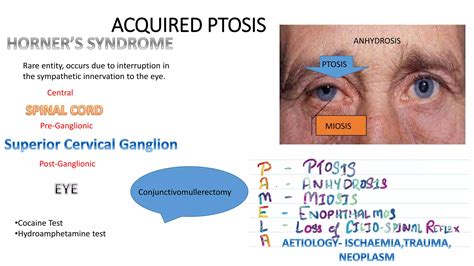 Anatomy Of Eyelid And Ptosis Pptx