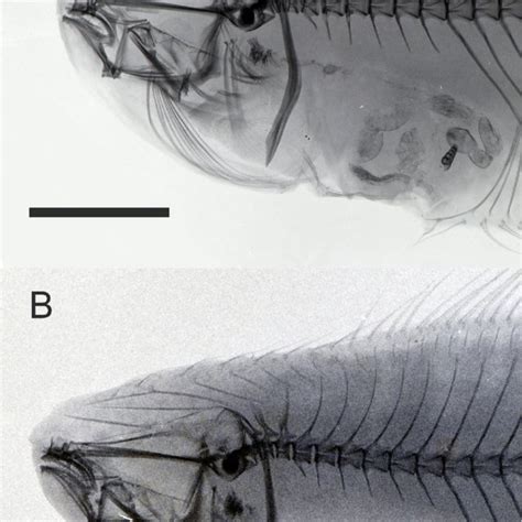 Radiographs Depicting Interdigitation Patterns Id Patterns Of