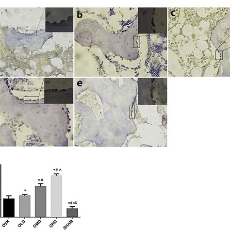 A Immunohistochemical Staining Of Runx2 Â40 Revealed The Different