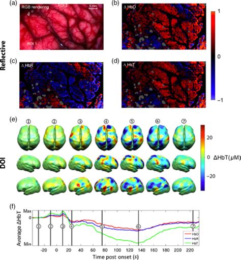 Noninvasive Hemoglobin Sensing And Imaging Optical Tools For Disease
