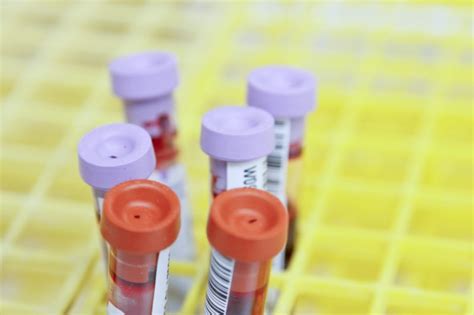 How To Ship Class 62 Infectious Substance Samples Packaging Guide