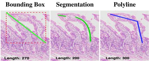 논문 리뷰 Measurenet Measurement Based Celiac Disease Identification