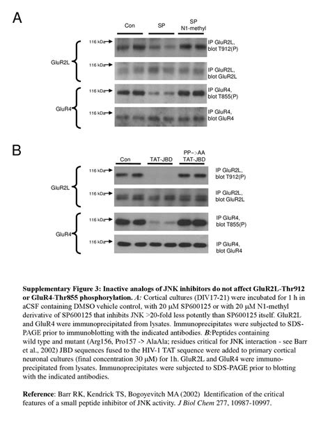 A Sp N1 Methyl Con Sp 116 Kda Ip Glur2l Blot T912p Glur2l 116 Kda