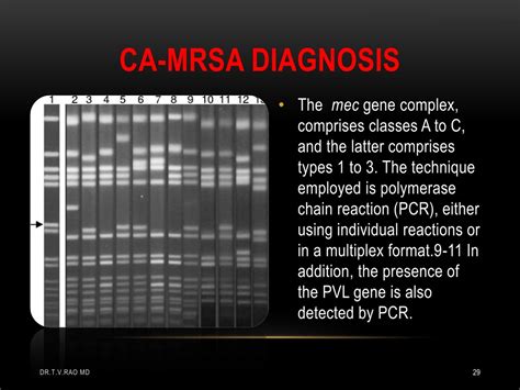 Ppt Community Associated Mrsa Ca Mrsa Powerpoint Presentation Free Download Id 195380