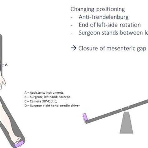 Exploration Of The Alimentary And Biliopancreatic Limb Closure Of The