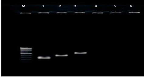 Figure 1 From Pathogenic Vibrio Parahaemolyticus Detection Through Pcr