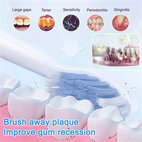 Dental Teeth Cleaner Separator Teeth Cleaner Dental Separator Cleaner