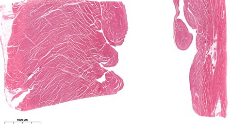 Histologia Del Miocardio Músculo Cardiaco Explicación Fácil