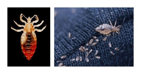 Bugs In Clothes Examples And How To Deal With Them
