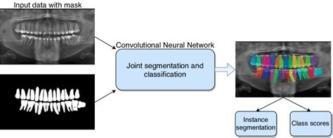 an example of a diagram of the joint segmentation and classification of