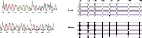 Analysis Of Insulin Dna Sequences In Human Tissues And Sera A