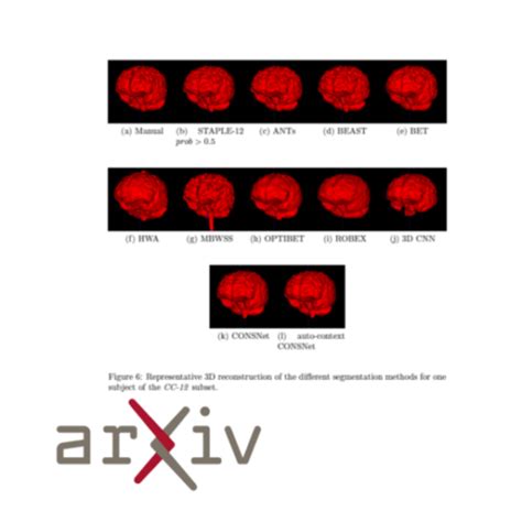 Convolutional Neural Networks For Skull Stripping In Brain Mr Imaging