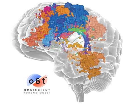 Ai Brain Health Leader Omniscient Closes Series C Funding