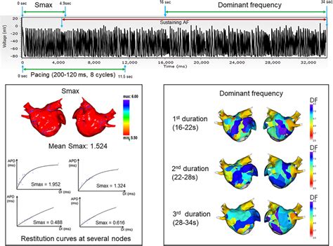 And Example Of How The Smax And Dominant Frequency Were Measured During