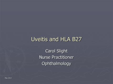 Uveitis And Hla B27 Ophthalmic Nurses Of Nz