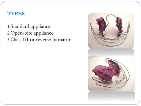 Ppt Myofunctional Appliances Powerpoint Presentation Free Download
