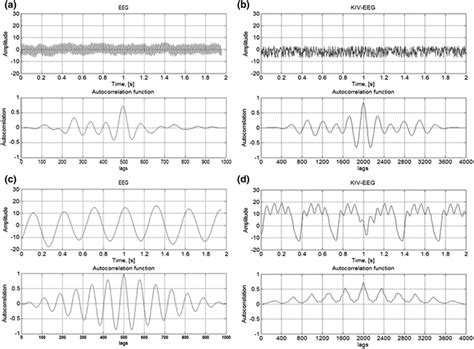 A Eeg Figures Featuring Autocorrelation Diagrams Where The Normal Download Scientific Diagram