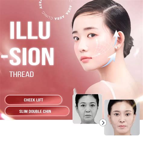 Thread Lifting Aura Clinic