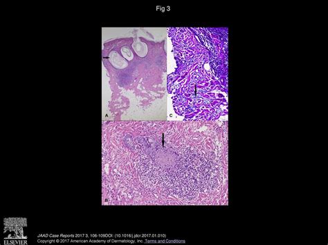 Volume 3 Issue 2 Pages March 2017 Ppt Download