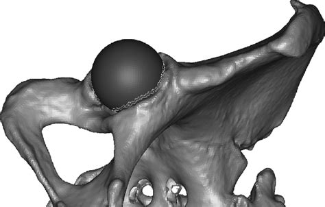 A Diagrams Showing Methods For Defining The Acetabular Coverage A Download Scientific Diagram