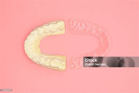 치과 석고 금형 및 치열 교정 실리콘 트레이너 분홍색 배경에 치과 교정을위한 모바일 치열 교정 기기 건강관리와 의술에 대한 스톡 사진 및 기타 이미지 Istock