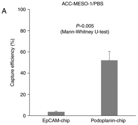 Capture Of Mesothelioma Cells With ‘universal Ctc Chip