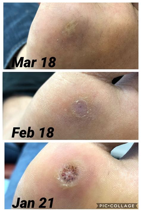 sample before and after scroller swift usa