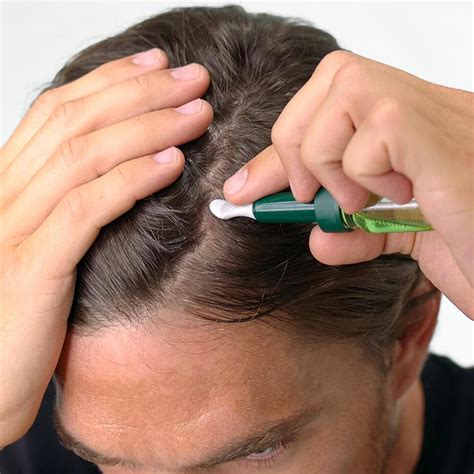 Physiology Of The Scalp Role And Composition Physiology Of The Scalp Role And Composition