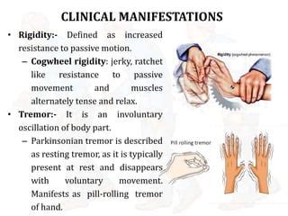 Parkinson Diseases Pptx
