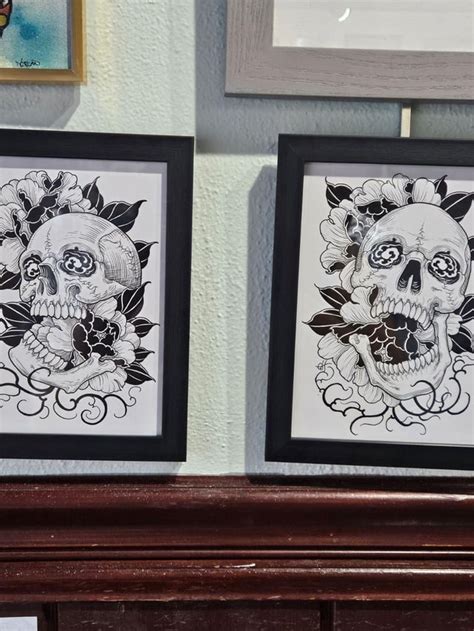 Botox Vs Trigger Point Injections R Tmj