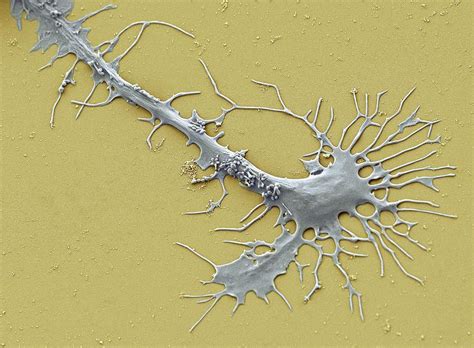 Stem Cell Derived Neuron Growth Cone Photograph By Thomas Deerinck