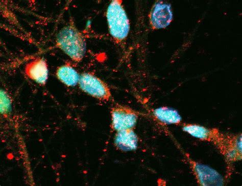 pedro morais on linkedin long 3′utrs predispose neurons to