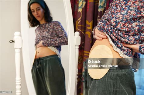 거울에 비친 장루 가방을 보고 있는 젊은 여성 소화기 암의 자부심 스토마 해부학에 대한 스톡 사진 및 기타 이미지 스토마 해부학 가방 거울 Istock