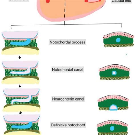 Stages Of Secondary Neurulation Beginning Just As The Posterior