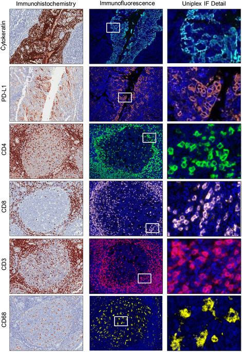 Validation Of Multiplex Immunofluorescence Panels Using Multispectral