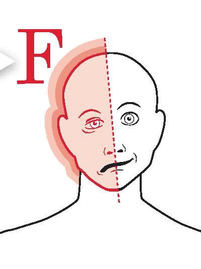 Stroke Health Insure Savvy