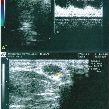 Imaging Study Echo Doppler Download Scientific Diagram