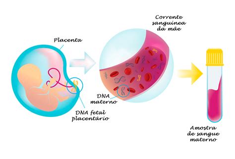 Eritroblastose Fetal Mind Map