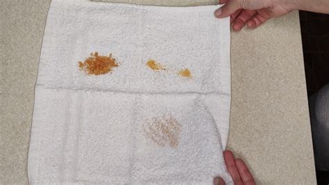 2 літри окропу як відіпрати кухонні рушники від жиру і плям і позбутися запаху Читайте на Ukr Net