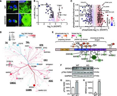 Proteomic Profiling Of Sacsin Ko Cells Download Scientific Diagram