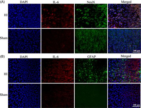 Location Of Interleukin Il‐6 In The Neuron And Astrocytes After Hi