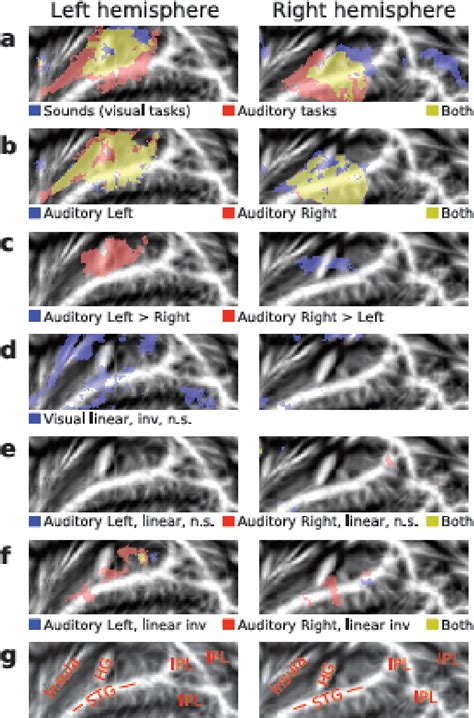 Figure 1 From Activations Of Human Auditory Cortex During Visual And Auditory Selective