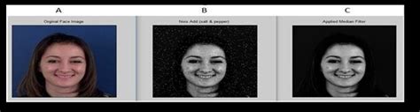 Image Pre Processing Steps A Input Image B Noise Add C Median Download Scientific