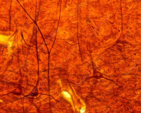 Pyramidal Cells In Cerebral Cortex Light Micrograph Stock Image C059 8201 Science Photo