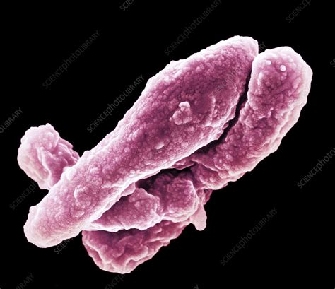 Bacillus And Clostridium Sem Stock Image C058 4759 Science Photo