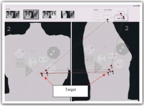 Simulated Radiology Gui Evaluation With Eye Tracking Moise Et Al 2006 Download Scientific