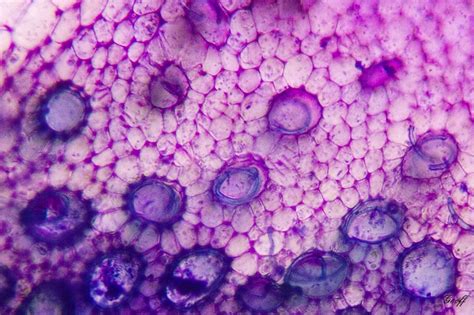 Collenchyma Under Microscope